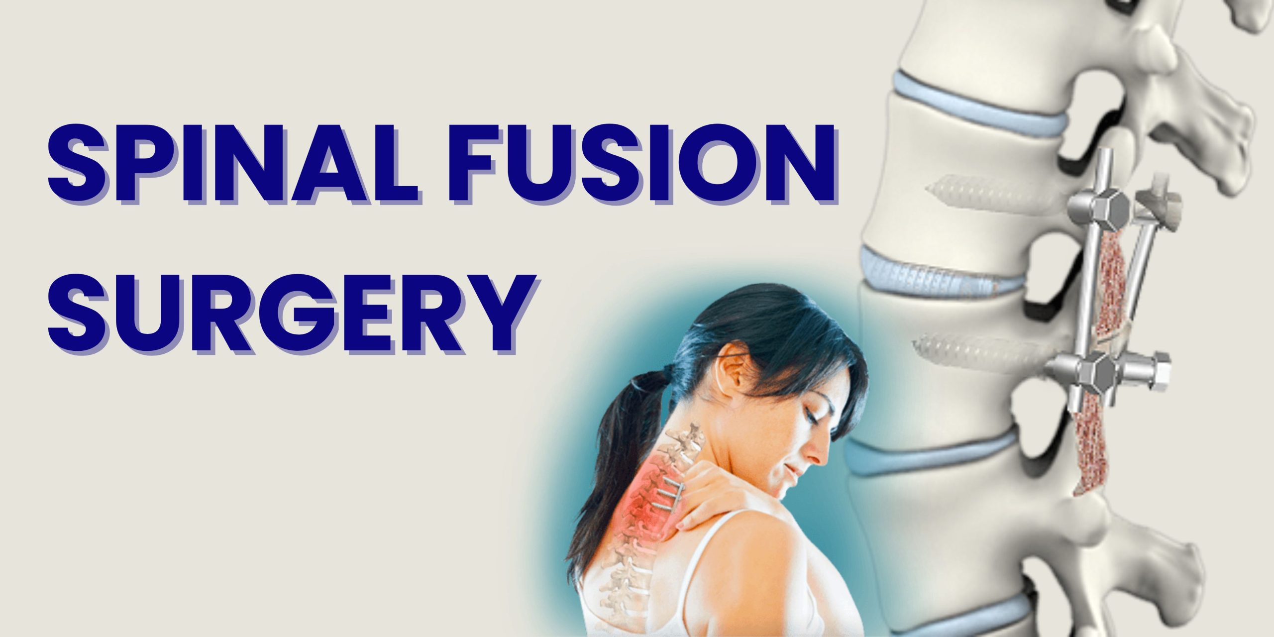 How Spinal Fusion Surgery Can Help You Get Back to Normal Life