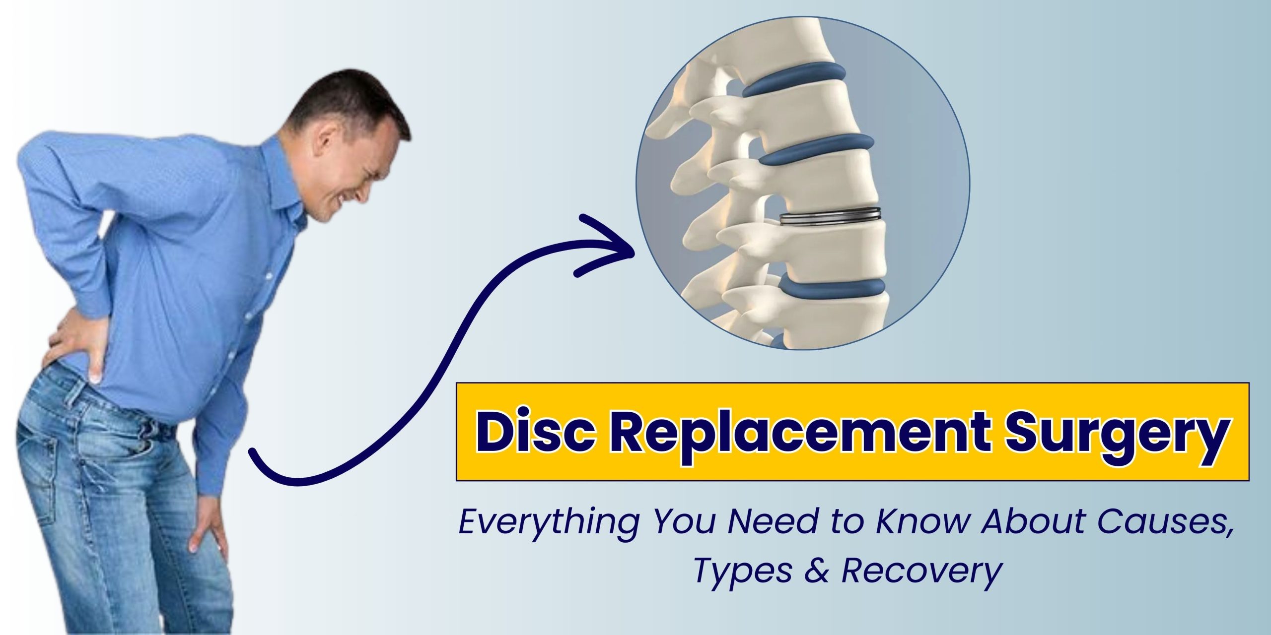 Disc Replacement Surgery: Everything You Need to Know